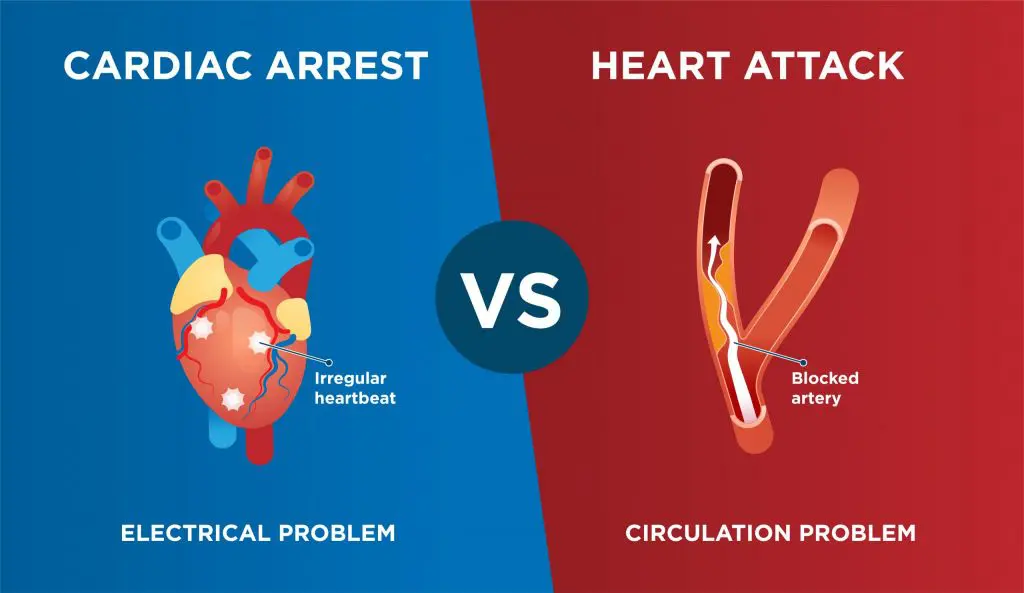 How To Prevent Cardiac Arrest Everything About Symptoms And Risks